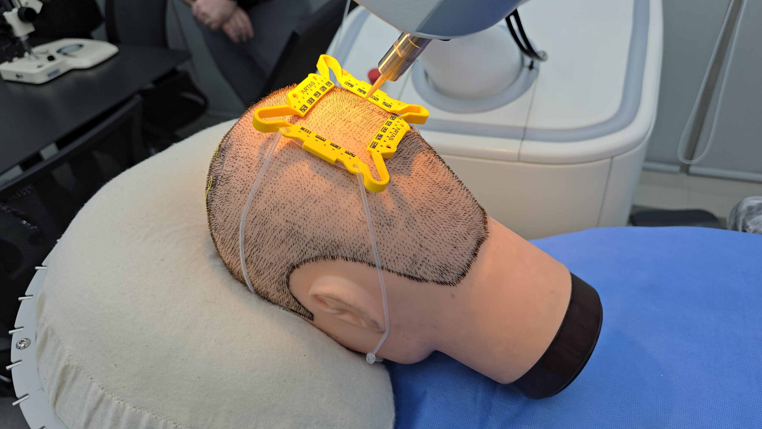 Artas iX, robot avanzado en materia de trasplante capilar, llegó a ...
